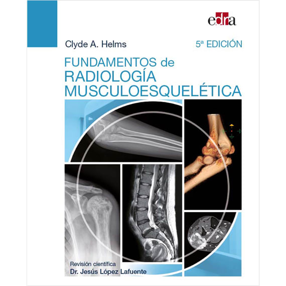 Helms Radiologia Musculoesqueletica | Librería Alex Books