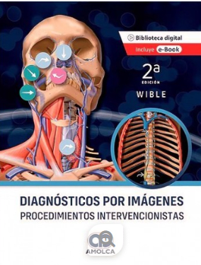 Wible Diagnosticos por imágenes Procedimientos Intervencionistas 2 ed ...
