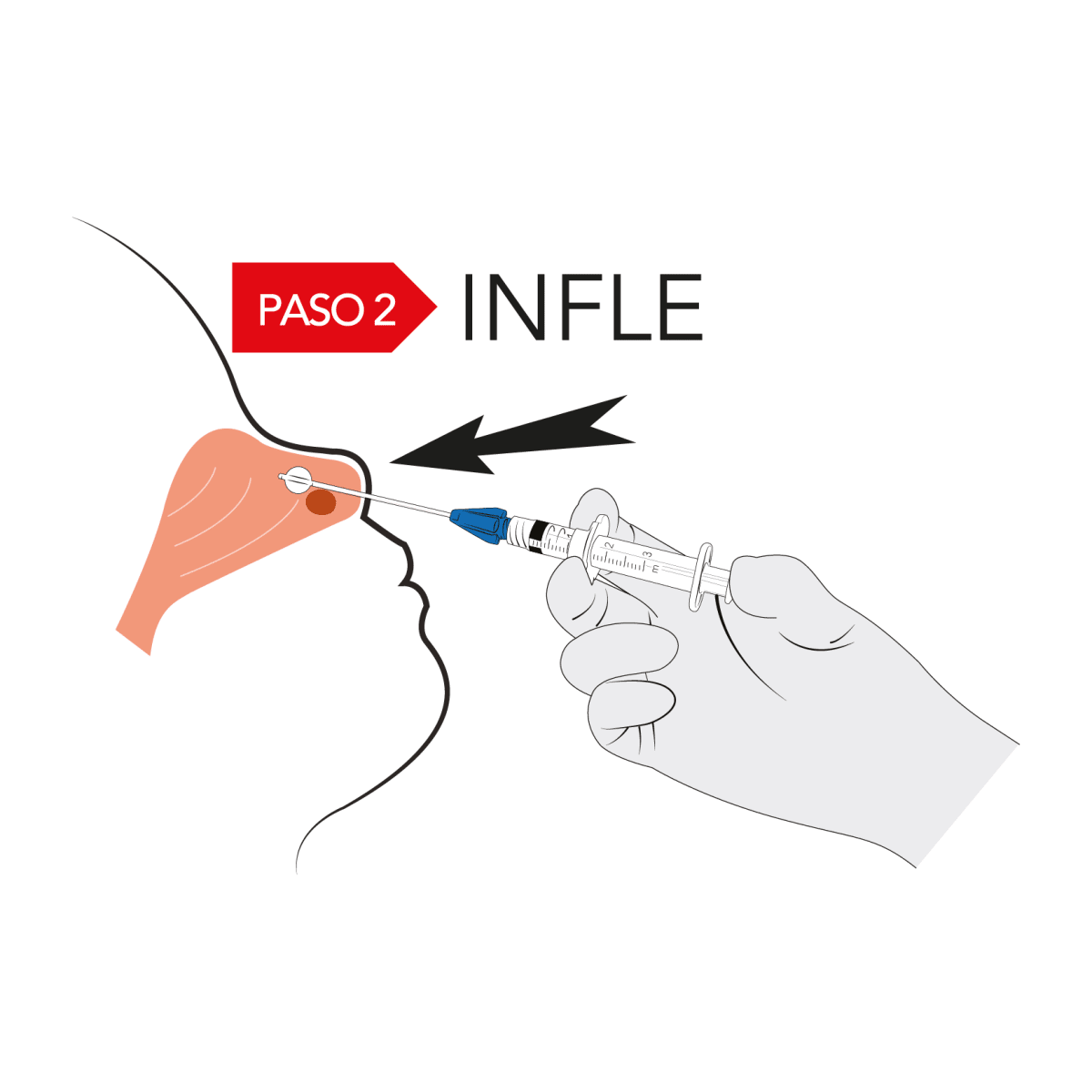 Katz Extractor® | Techsalud