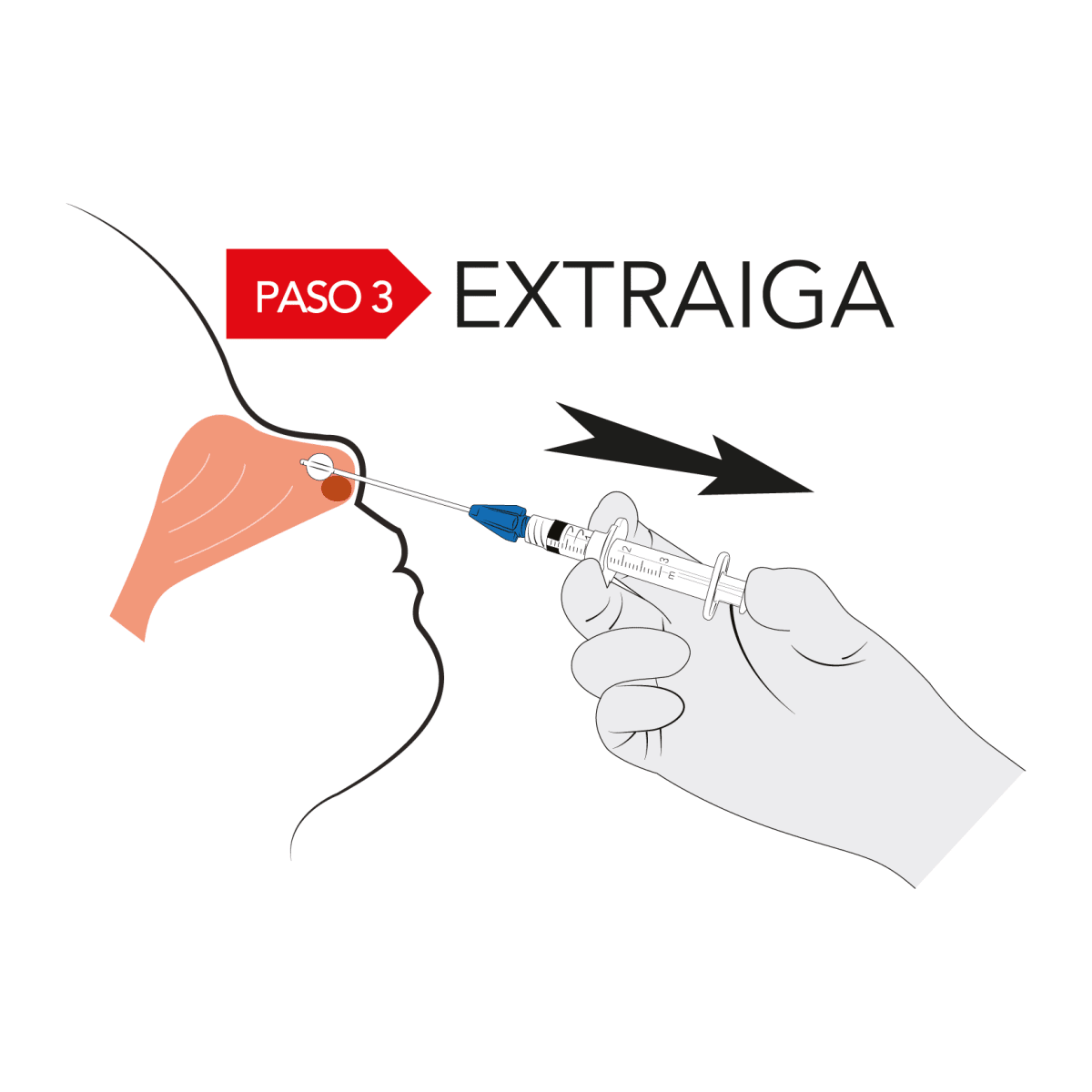 Katz Extractor® | Techsalud