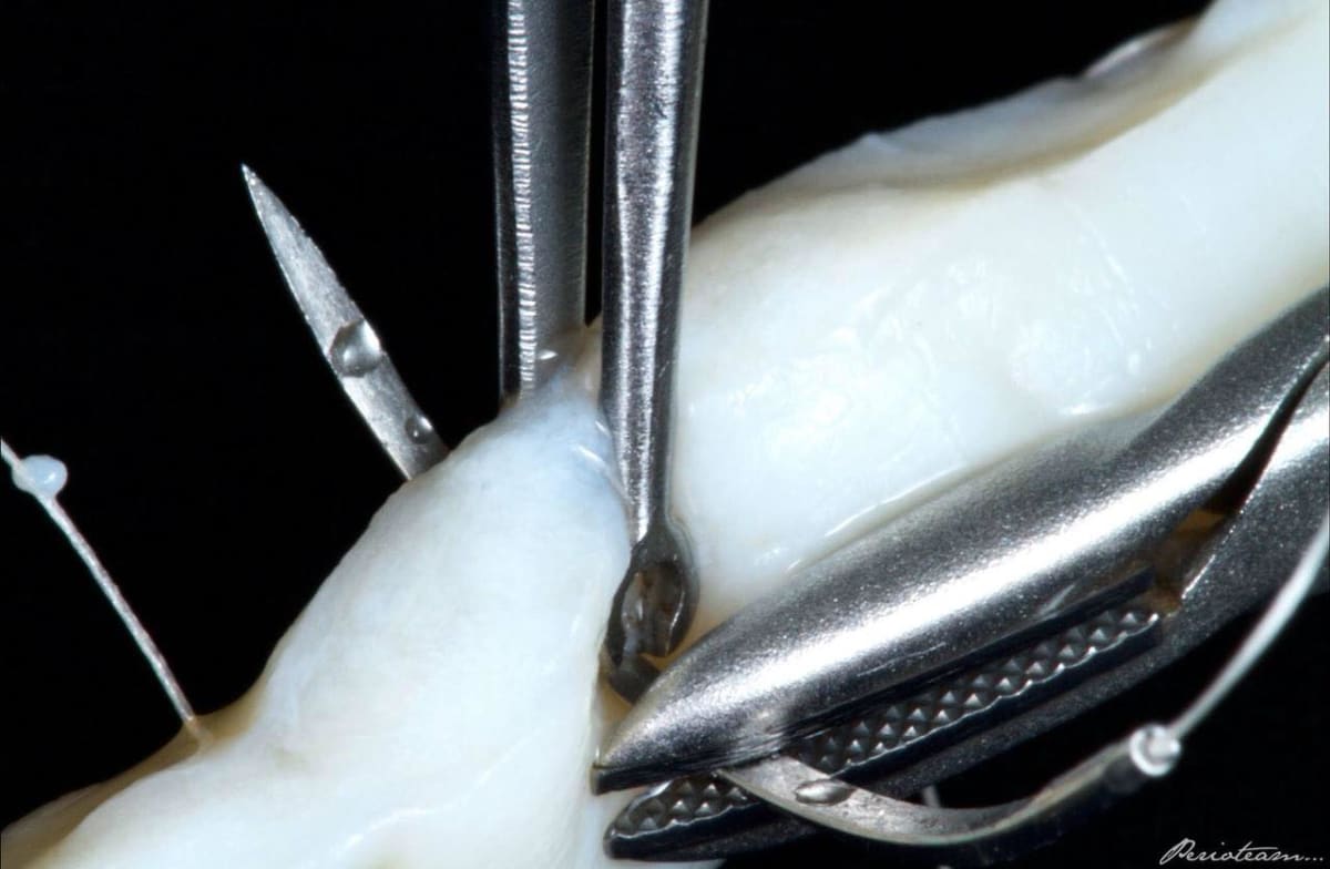 OrACELL Matriz Dérmica Acelular 1.26 - 1.75MM | Via Ossea