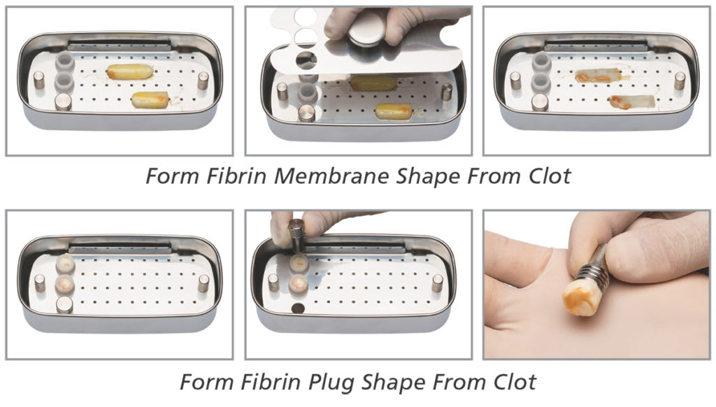 Salvin PRF Box | Biomateriales Chile